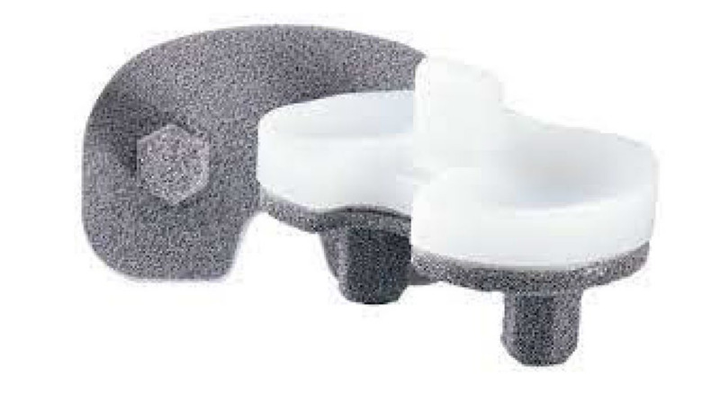 Trabecular metal Modular tibial tray knees has better functional ...