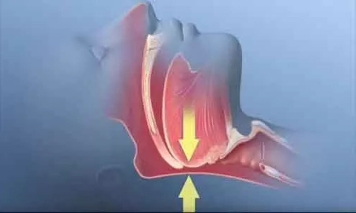 Respiratory muscle training promising for managing symptoms of ...