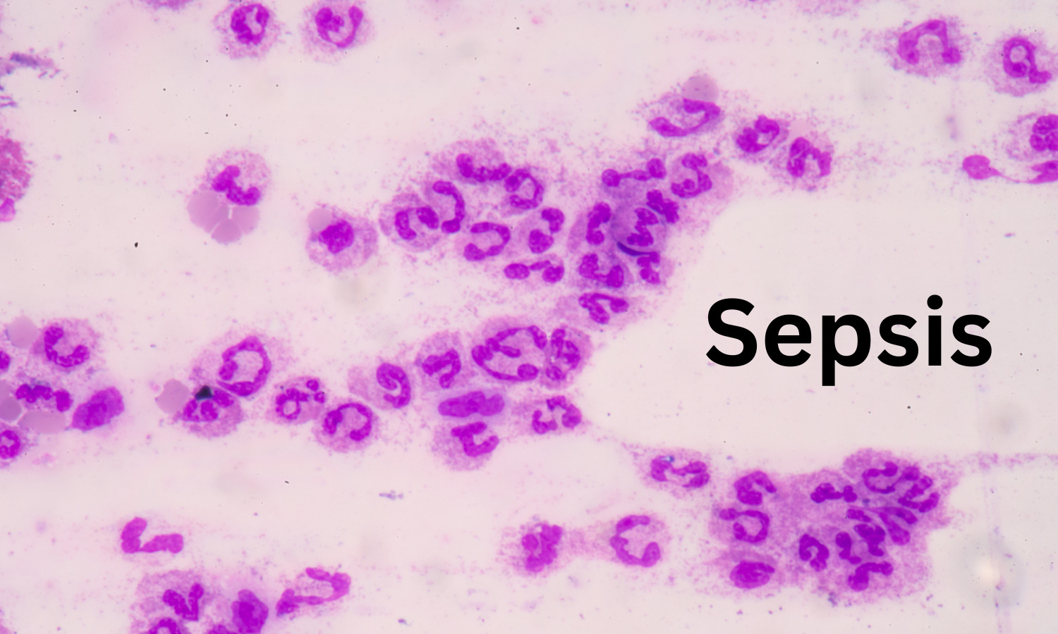 Delayed time-to-antibiotics may increase 28-day mortality in sepsis ...