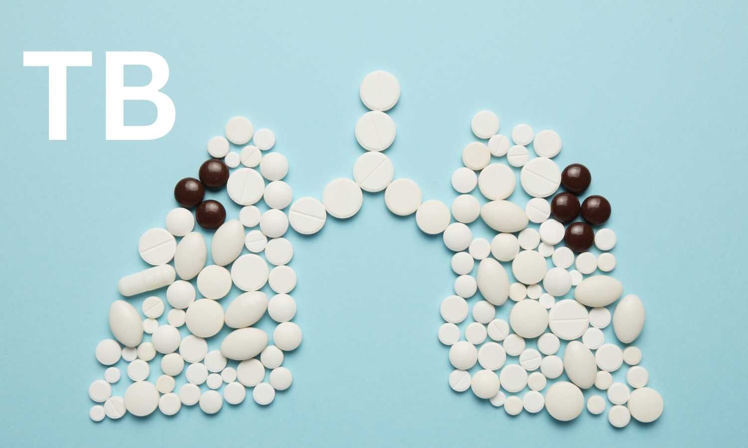 Is four-month high-dose rifampicin regimen noninferior to the standard ...