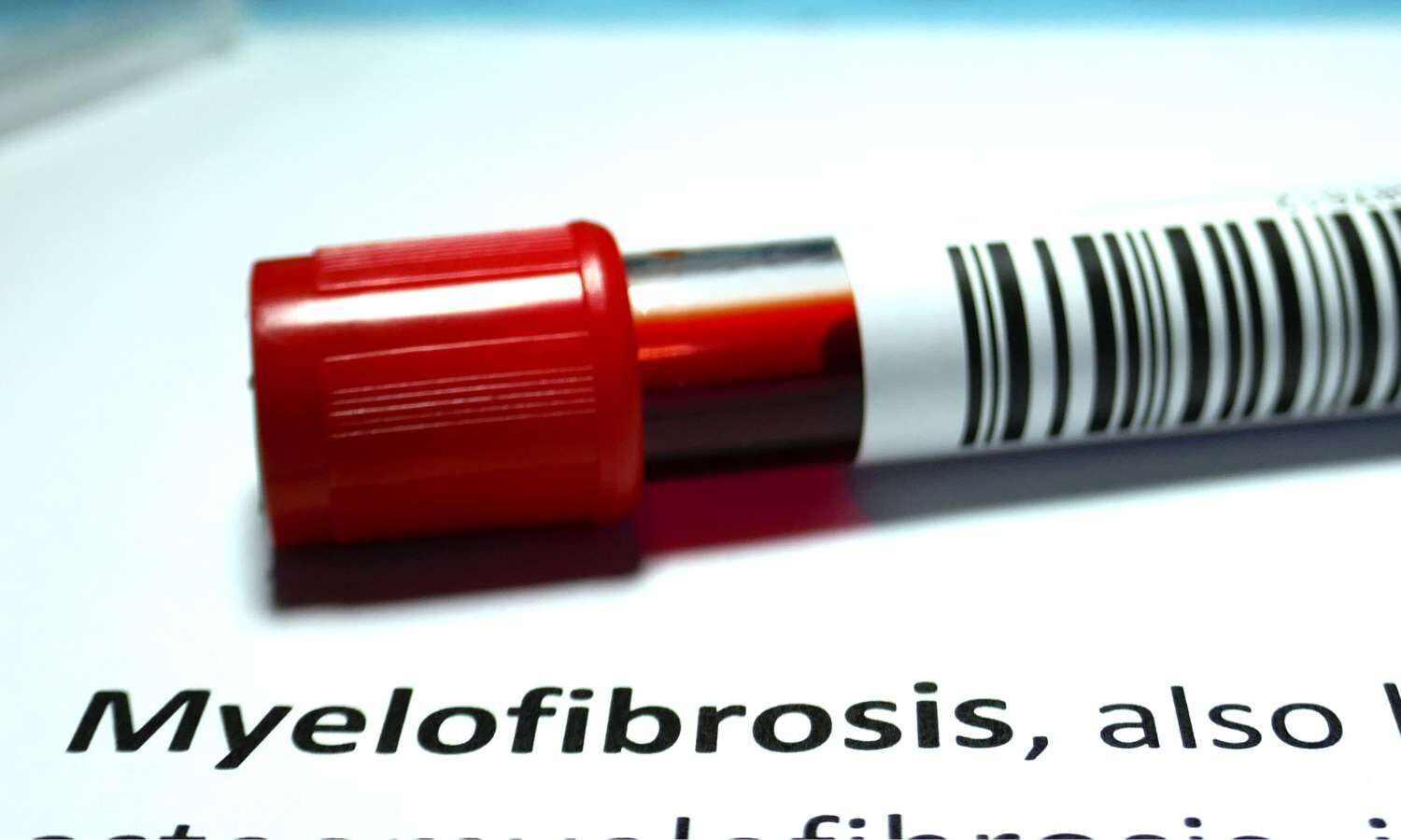 Targeted therapy momelotinib significantly improves symptoms and anemia ...