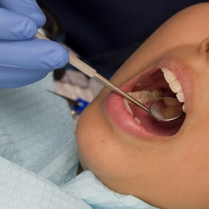 Gum disease and tooth loss linked to brain shrinkage