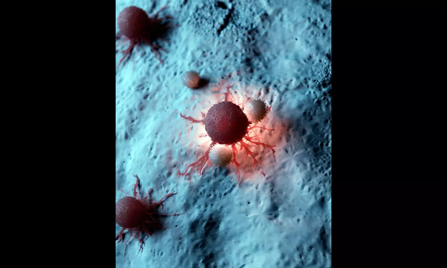 Urological (Genitourinary) Cancers