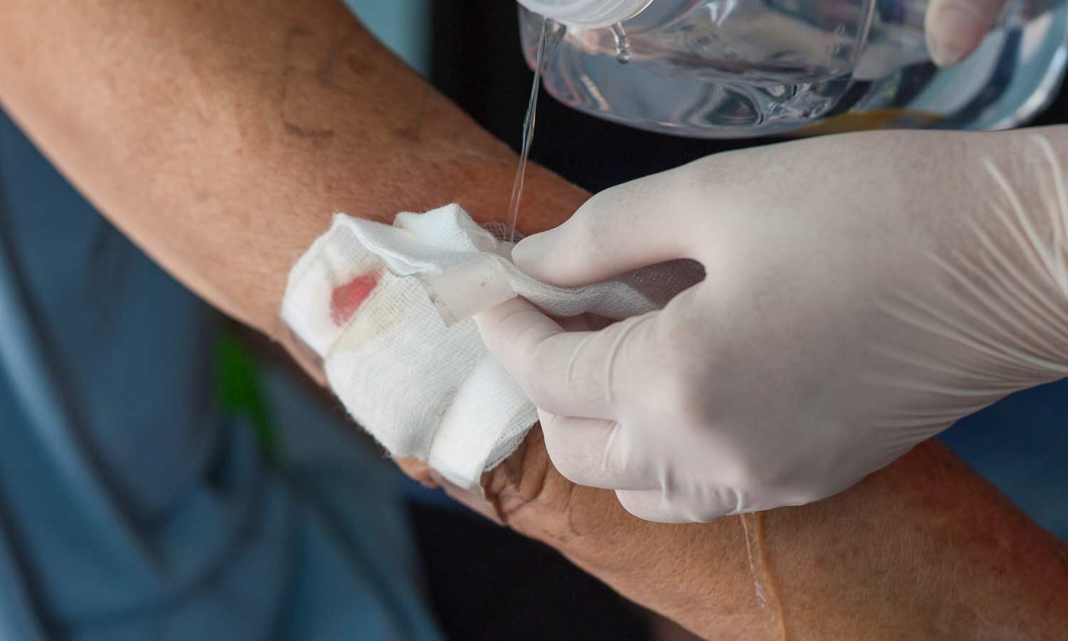 An algae product holds potential for skin regeneration and wound ...