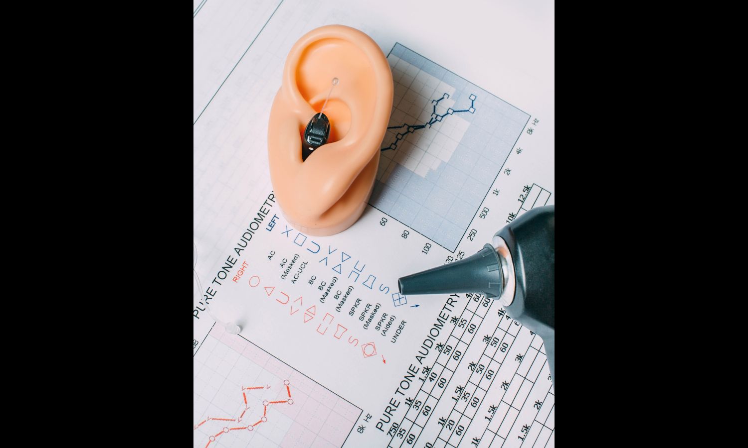 International Cochlear Implant Day: Tuning Into The Music Of Life