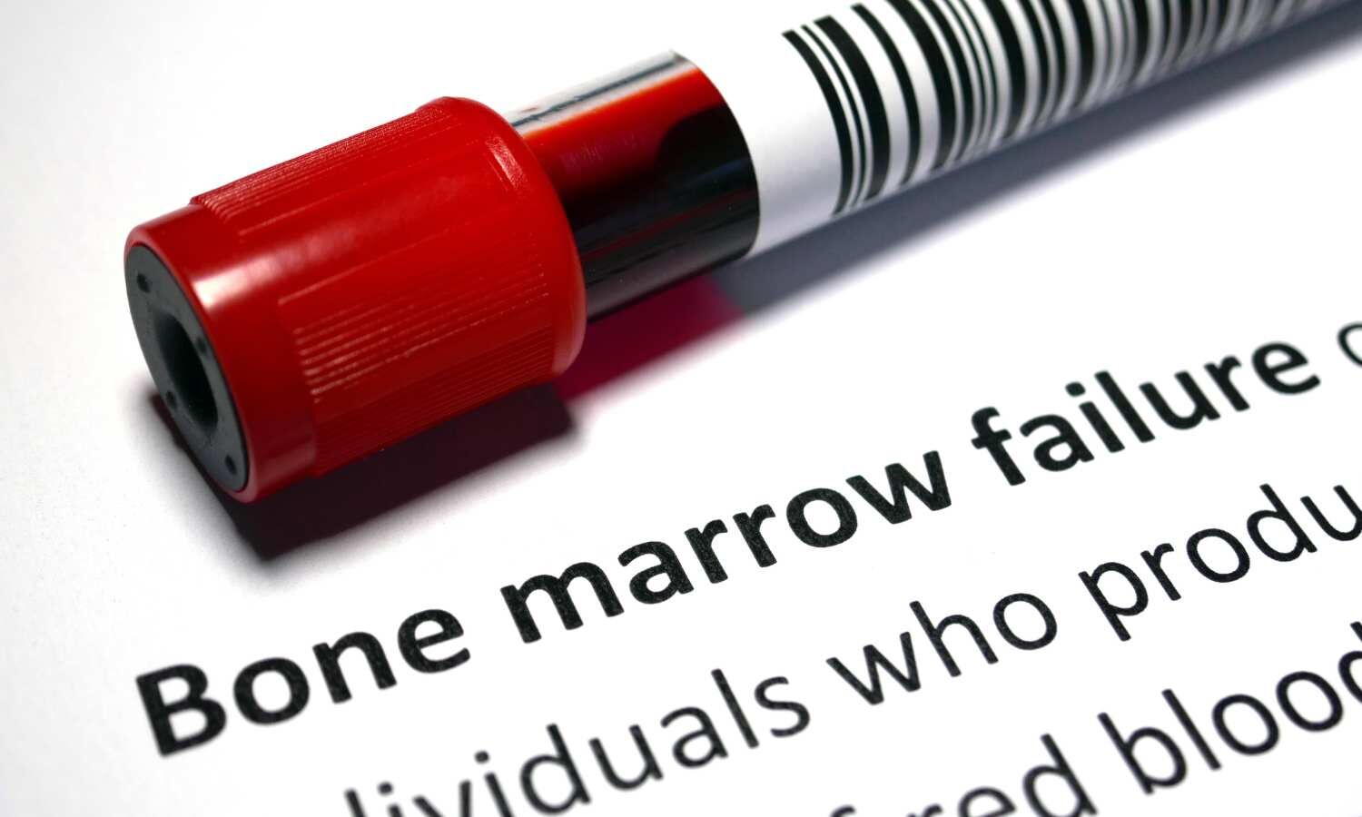 Possible treatment strategy identified for bone marrow failure syndrome