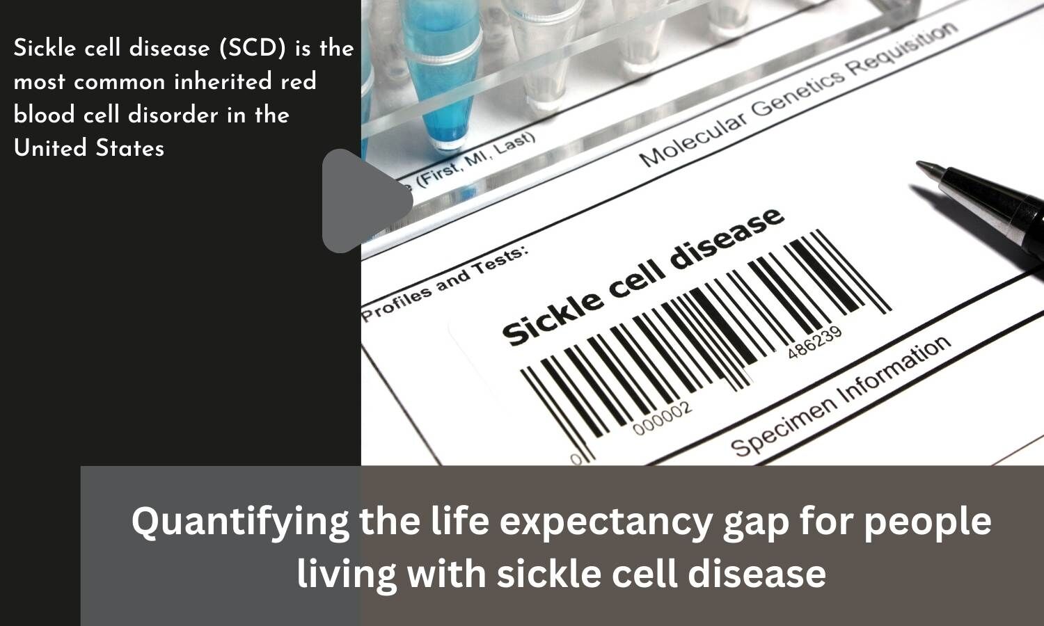Quantifying the life expectancy gap for people living with sickle cell ...