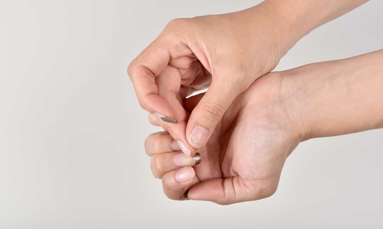 Total chemical matricectomy with phenol effective treatment of ...