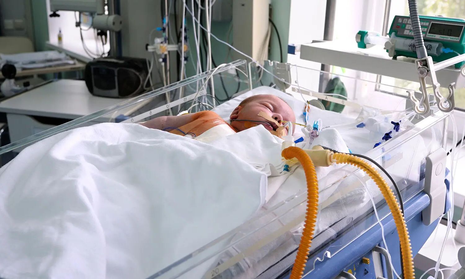 Early prostacyclin in diaphragmatic hernia tied to less life support ...