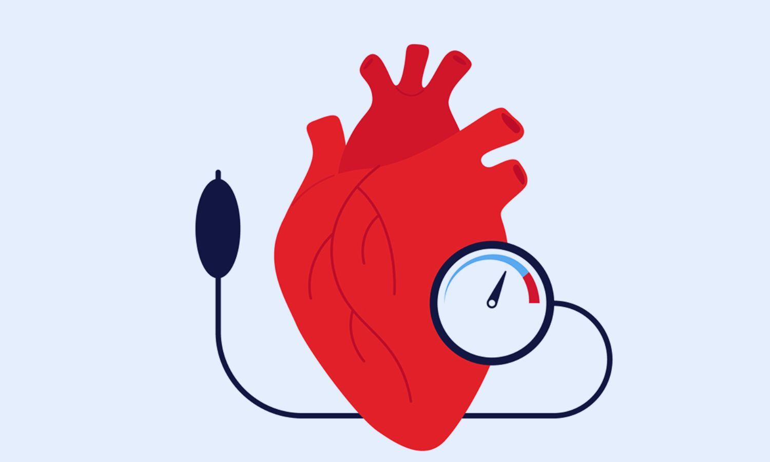 Using PA pressure sensor with CardioMEMS beneficial for LVAD patients ...