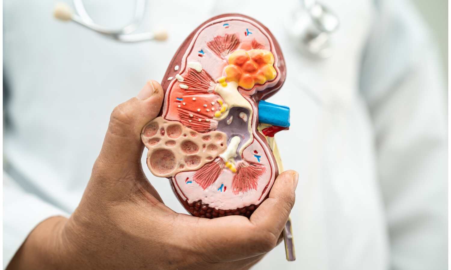 Extended lymph node sampling during surgery for pediatric renal tumours ...