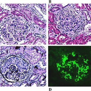 Cyclic neutropenia and concomitant IgA nephropathy: a case report