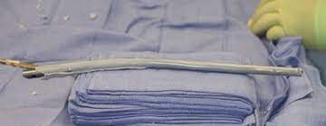 Antibiotic bone cement coated implant effective and feasible primary ...