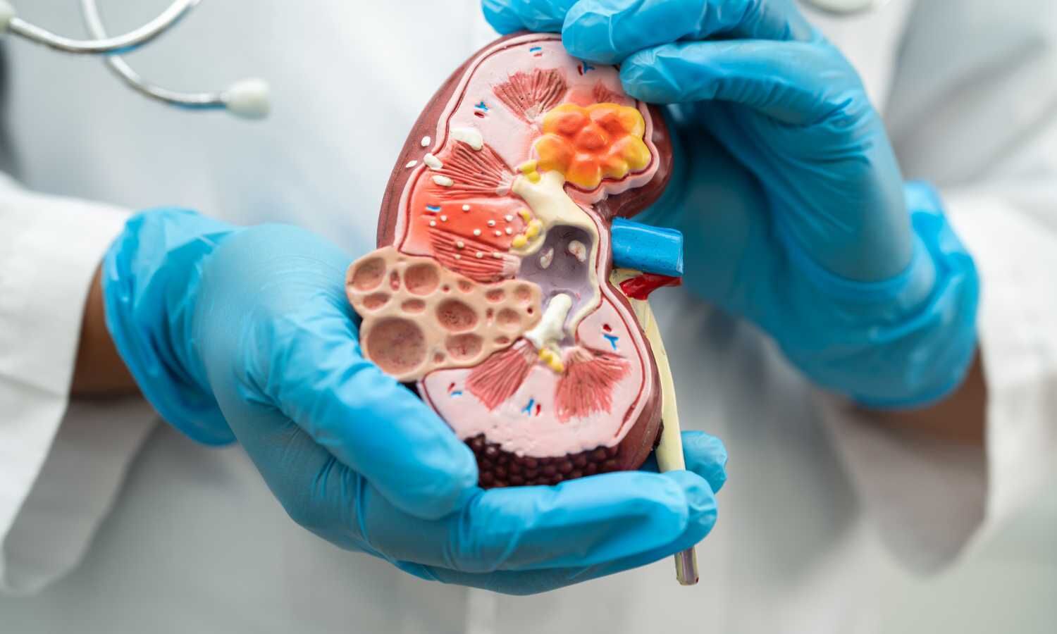 Study finds hypothyroidism closely associated with chronic kidney disease