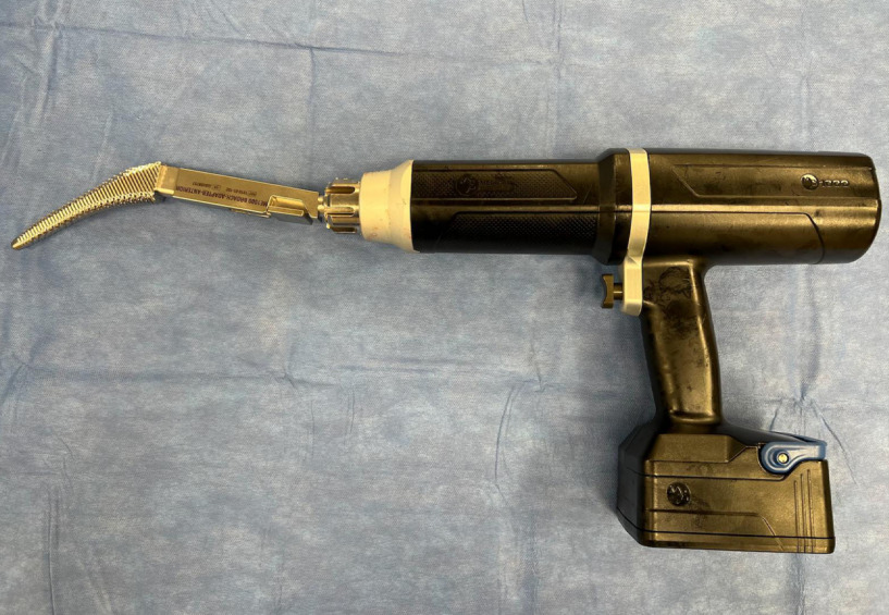 Automated impaction in primary THA safe technique for femoral ...