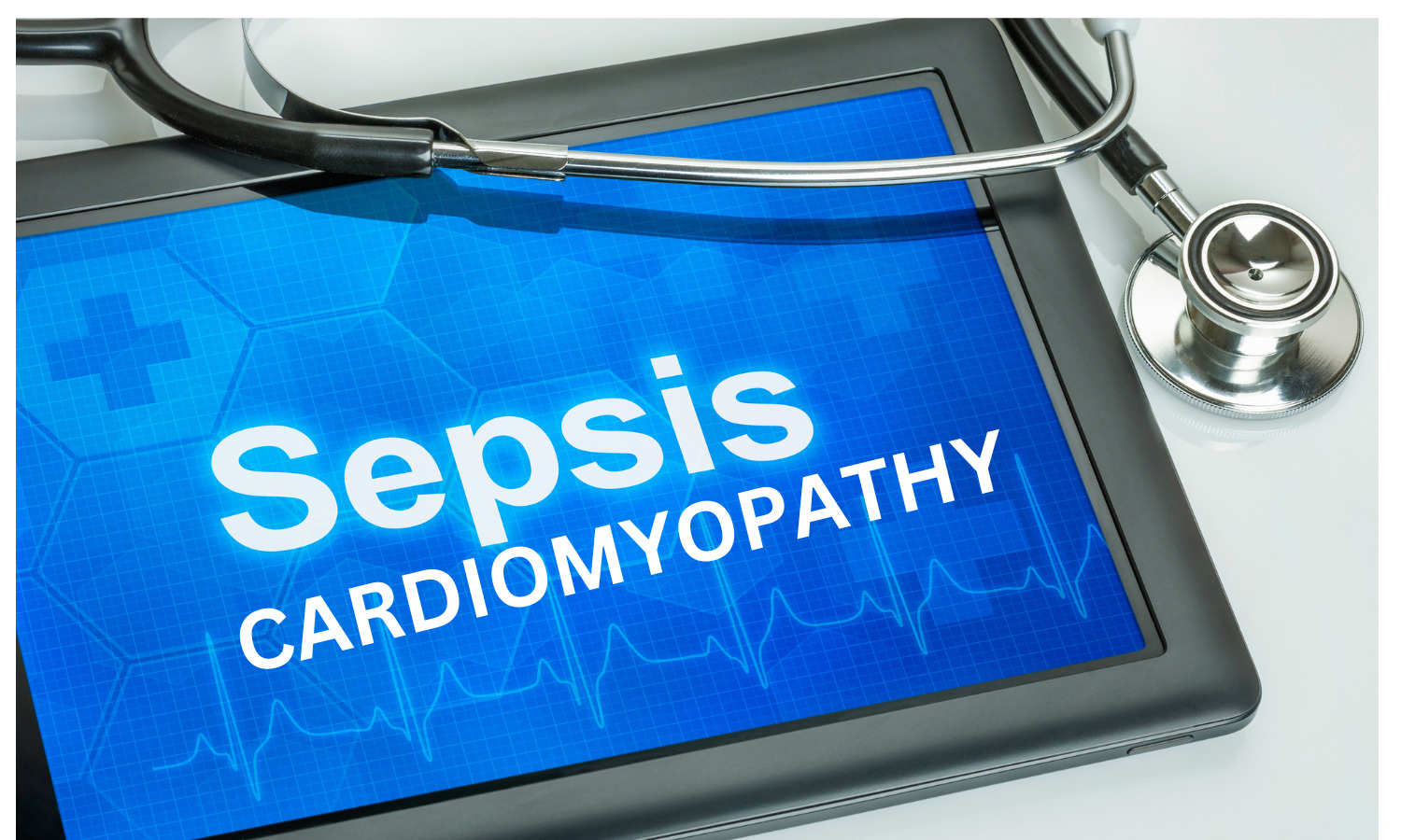 Sepsis Induced Cardiomyopathy associated with significantly higher ...