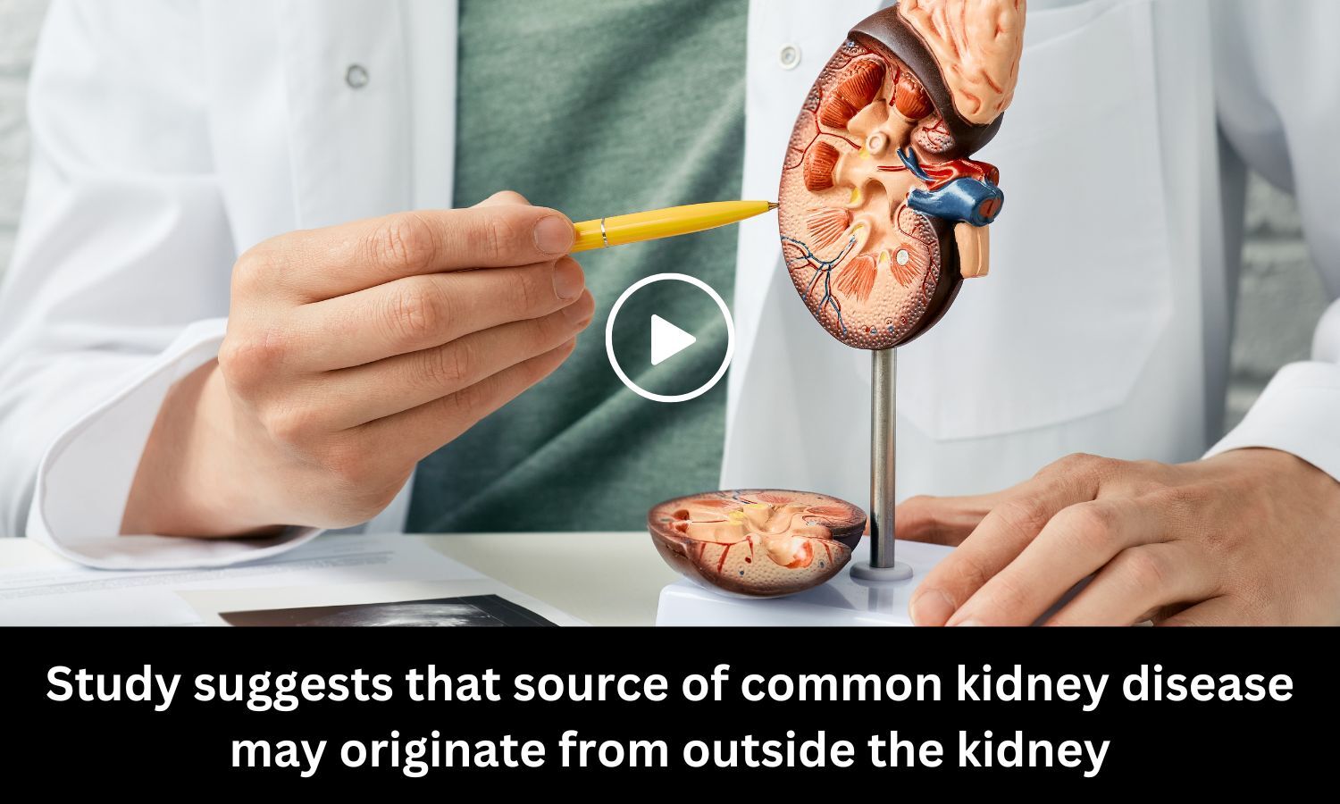 A study suggests that source of common kidney disease may originate ...