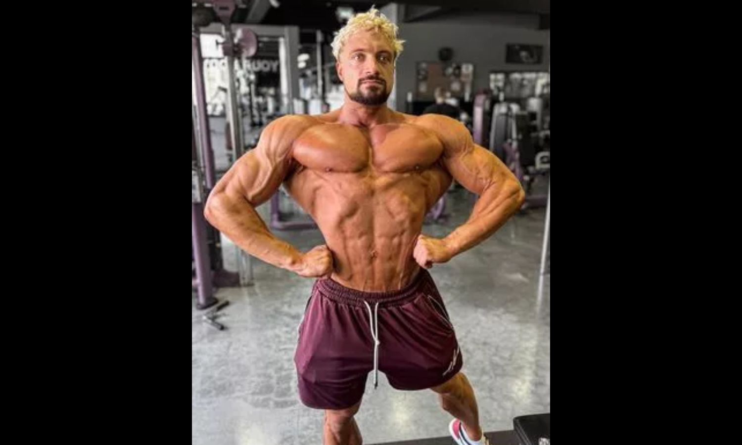 Know Aneurysm That Led To Bodybuilder Jo Lindner AKA Joesthetics's Death