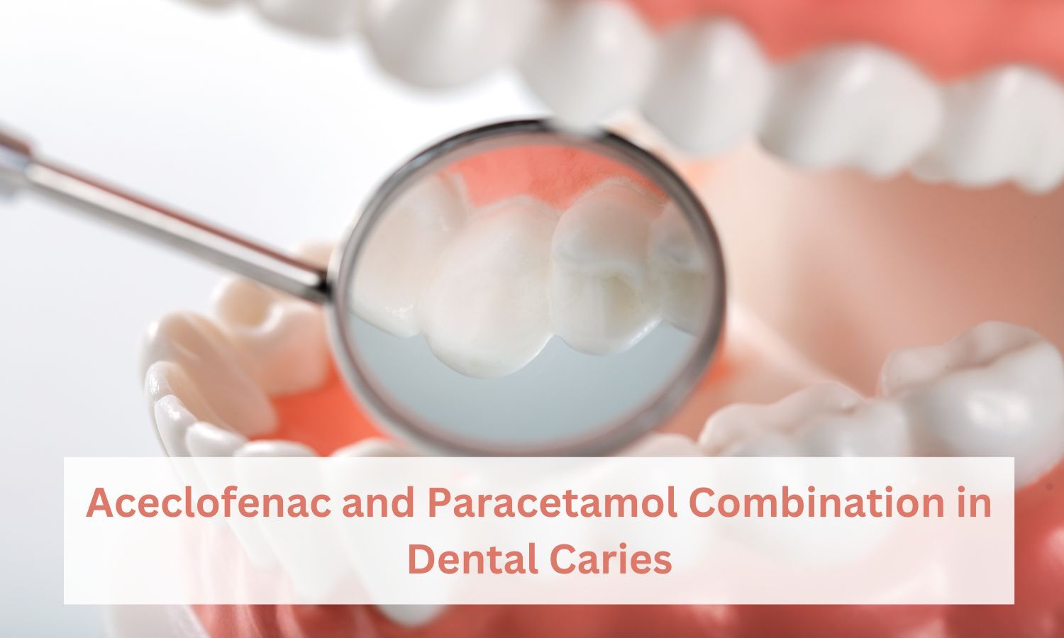 Dental Caries: Practitioners' Perspective and Rationale for Using ...