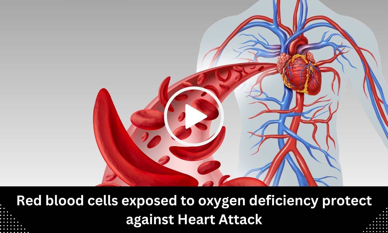 Red blood cells exposed to oxygen deficiency protect against Heart Attack