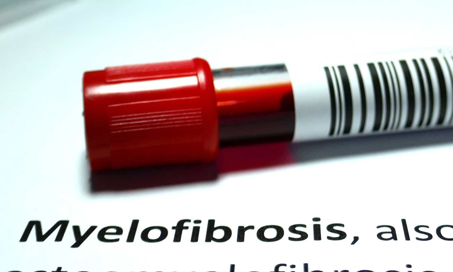 Momelotinib receives FDA approval for patients of myelofibrosis with ...