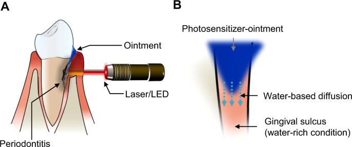 Transgingival antimicrobial photodynamic therapy may reduce microbial ...
