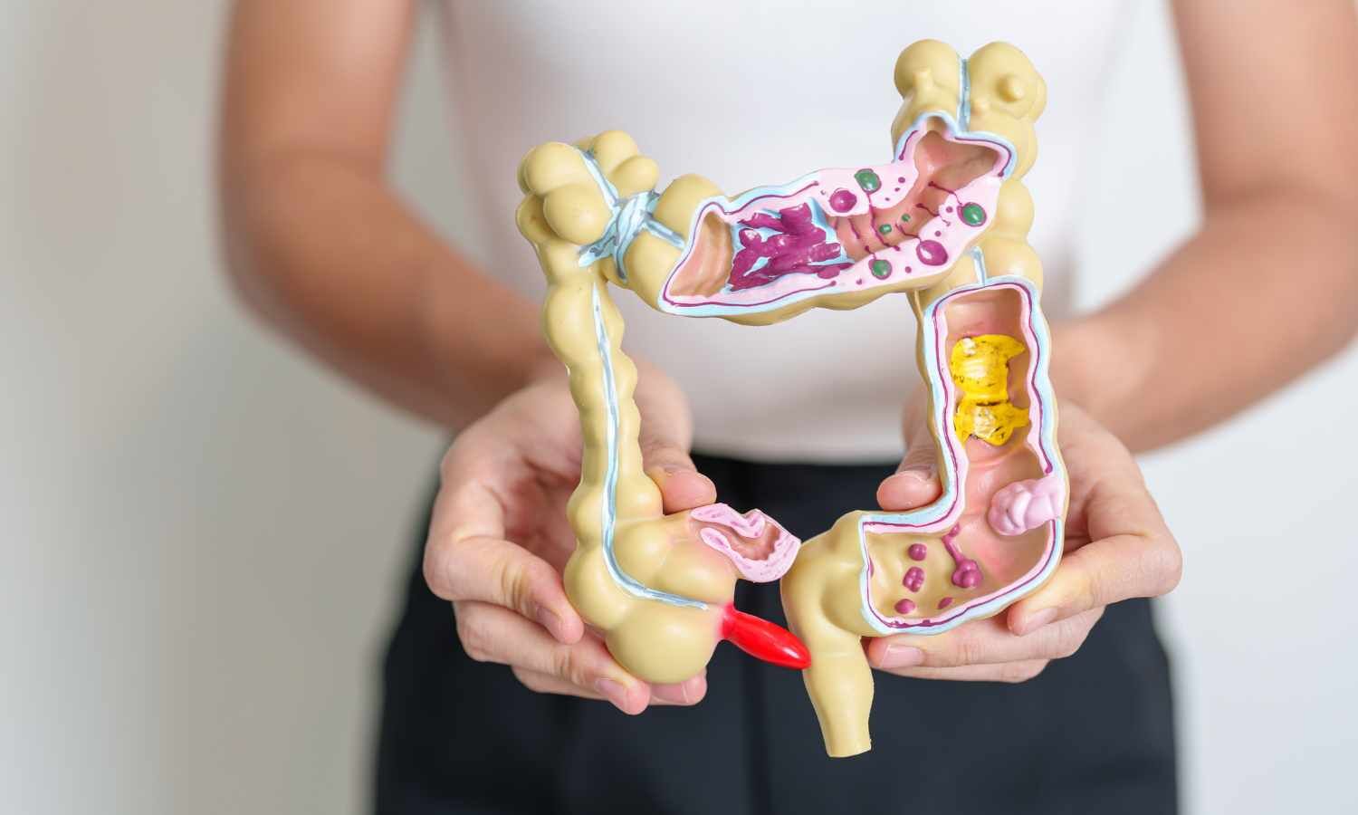 Researchers identify why cancer immunotherapy can cause colitis