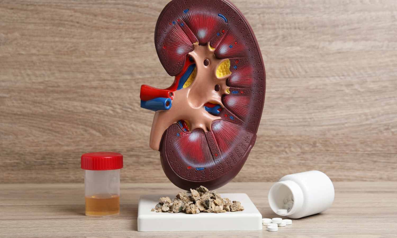 First full characterization of kidney microbiome unlocks potential to ...