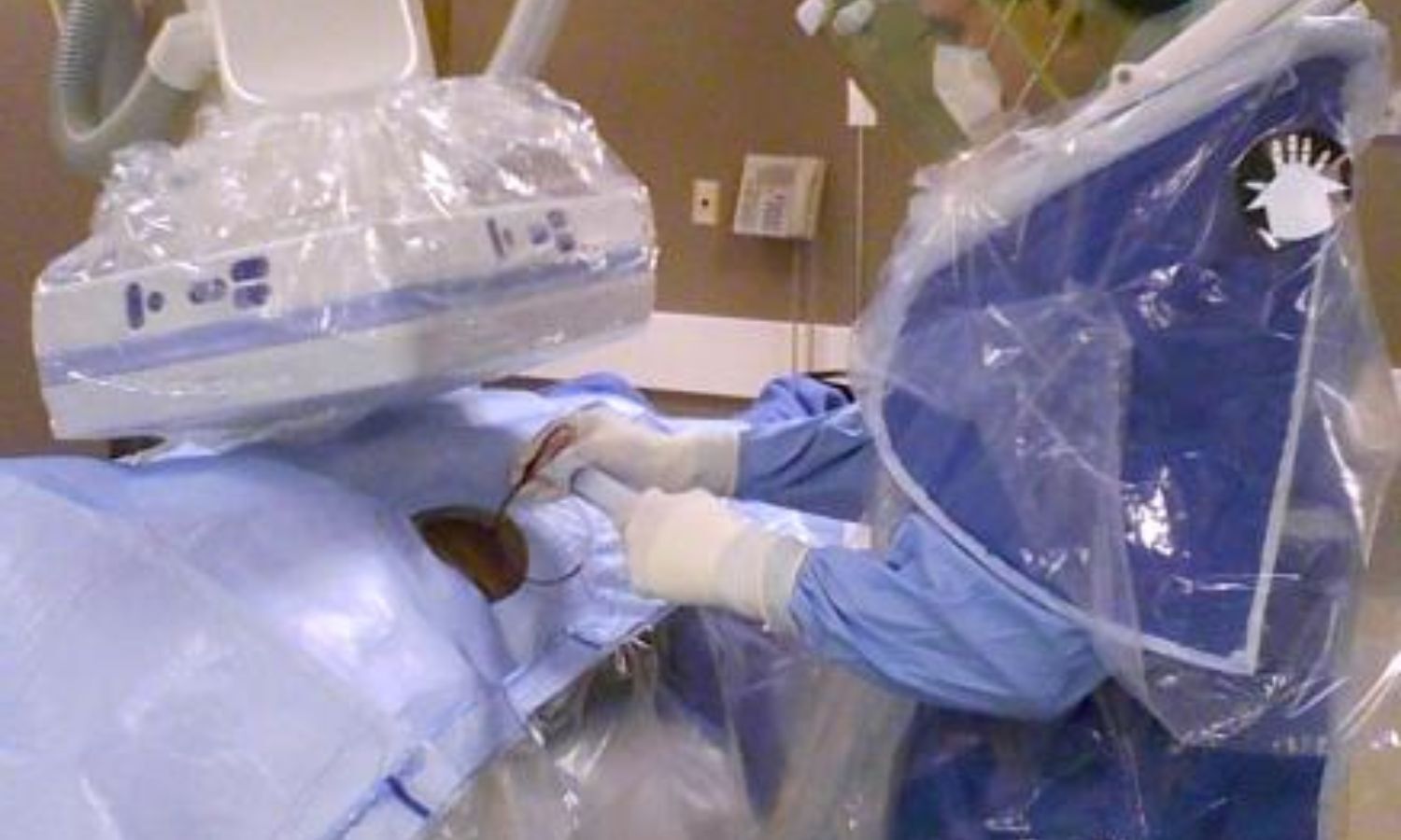 Study reveals high prevalence of radiation-induced cataracts among ...