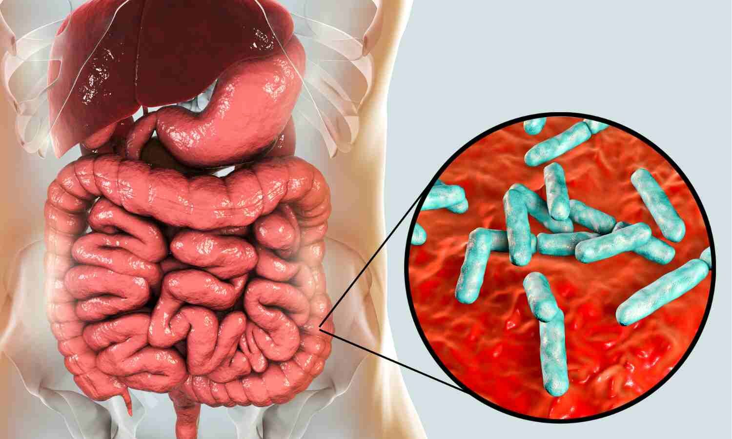'Unhealthy' gut microbiome patterns linked to heightened risk of death ...