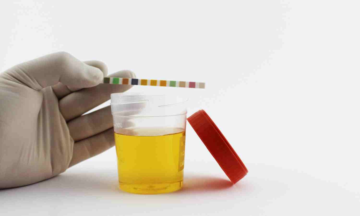 The rainbow of urine colors: What's typical, what's not