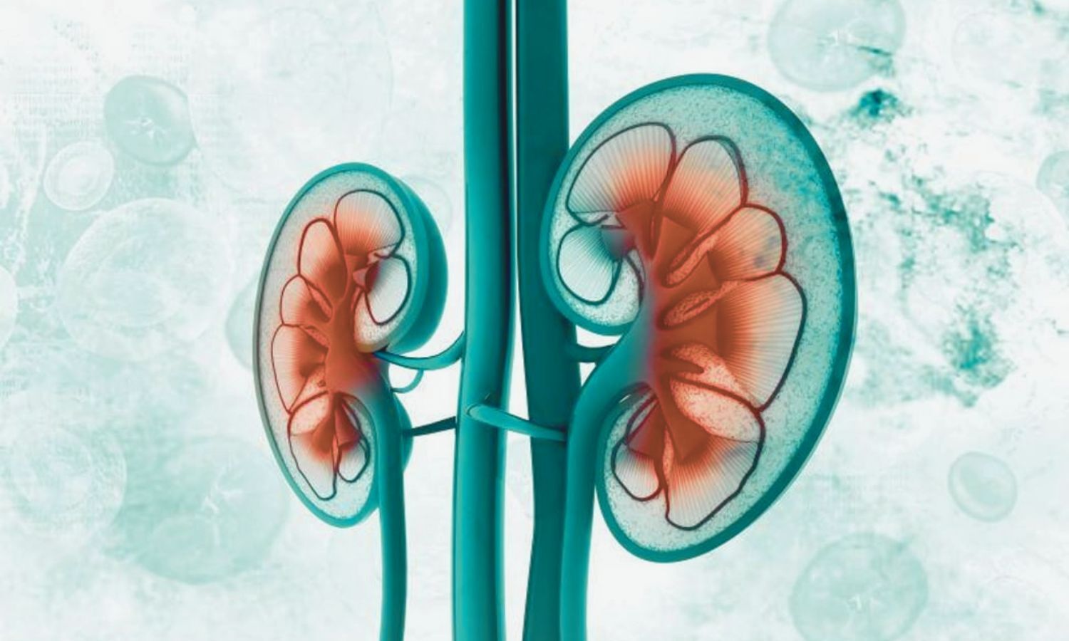 Children under continuous kidney replacement therapy have higher risk ...