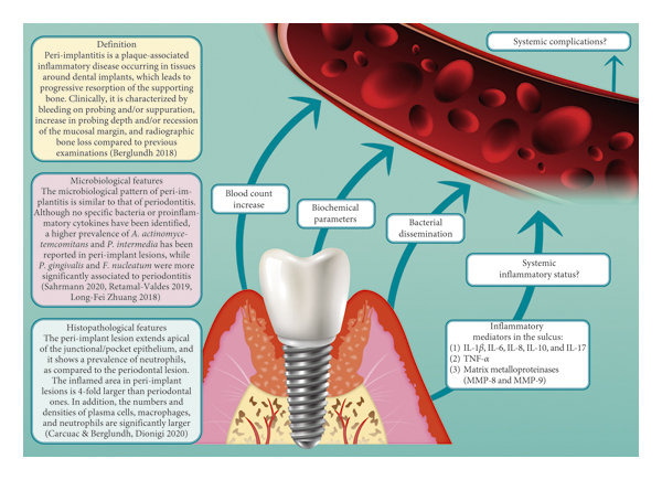 Higher levels of CRP associated with periodontitis with or without peri ...