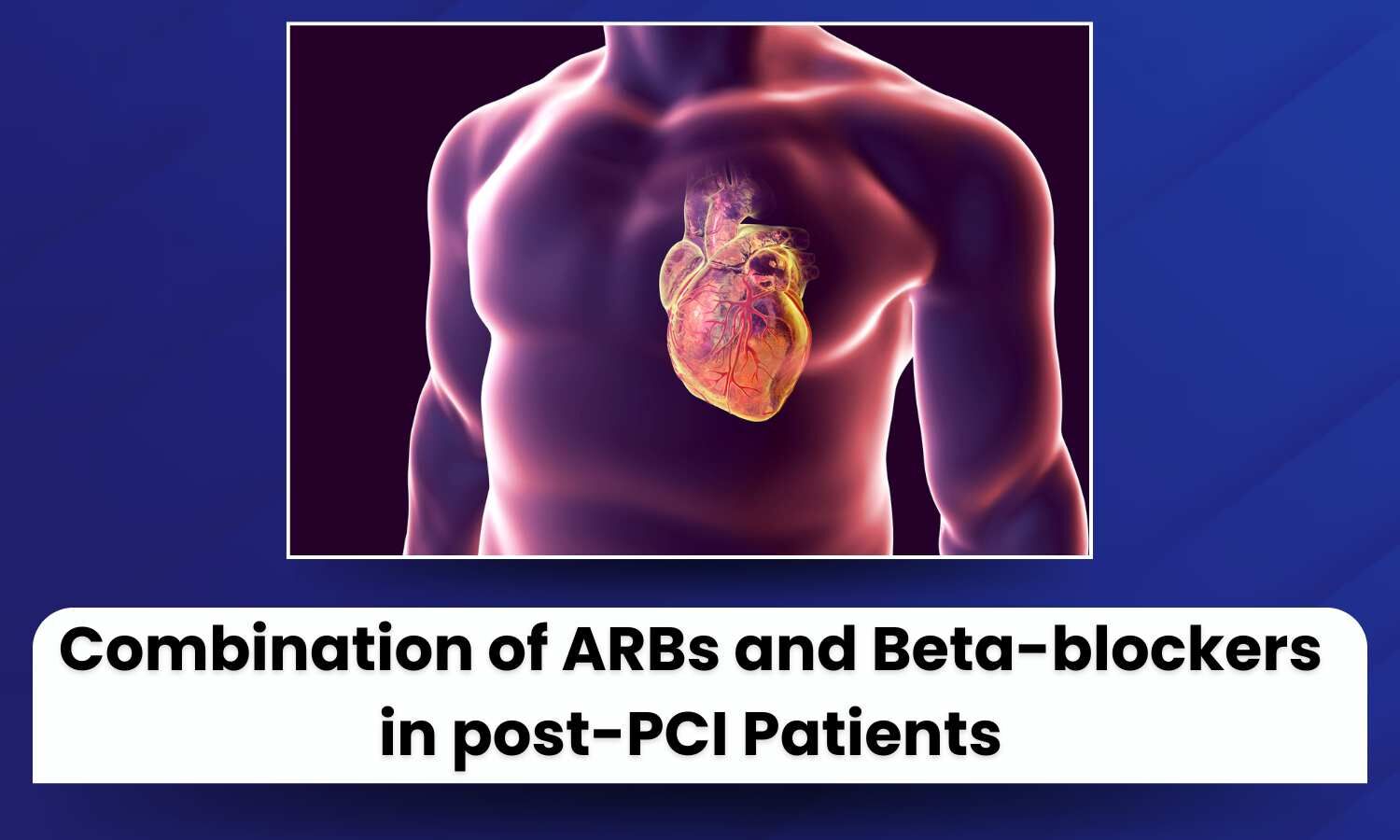 Combination therapy with ARBs and Beta-blockers for post-PCI patients ...