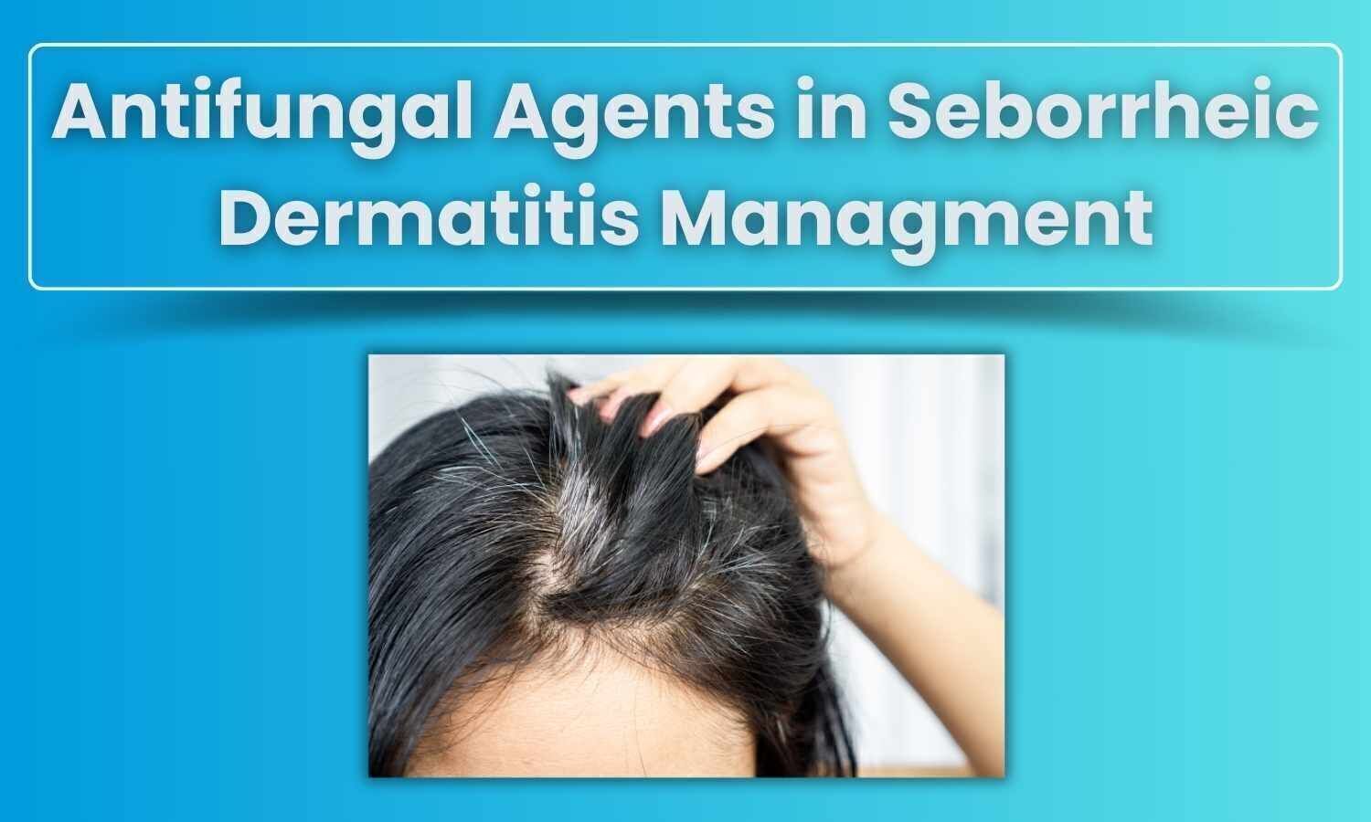 From Mystery to Management: The Ongoing Story of Seborrheic Dermatitis