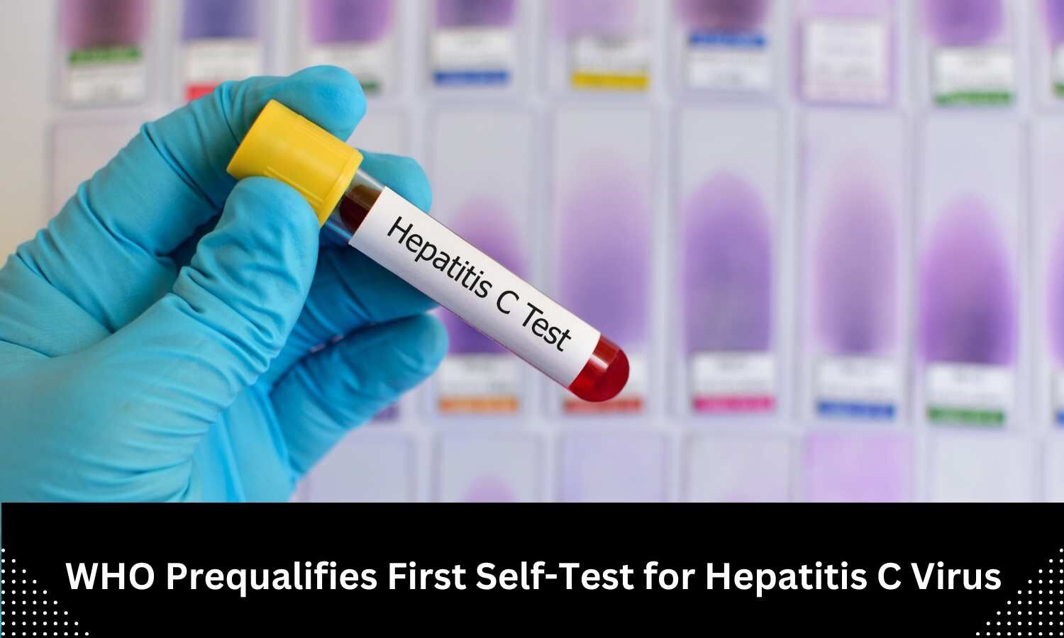 WHO prequalifies first hepatitis C virus self-test OraQuick