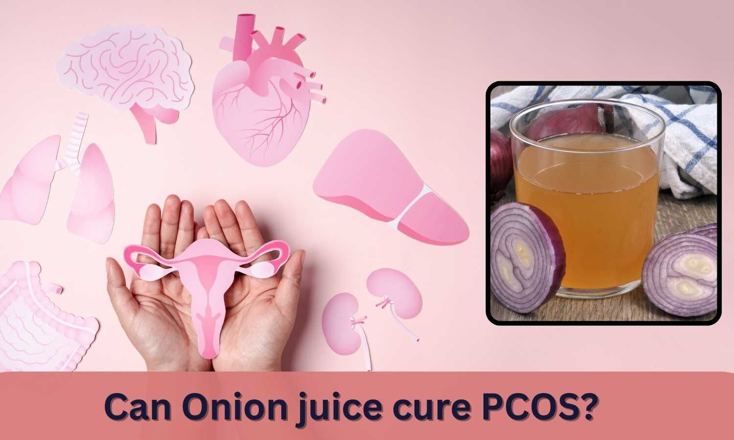 Fact Check: Can Onion juice cure PCOS?