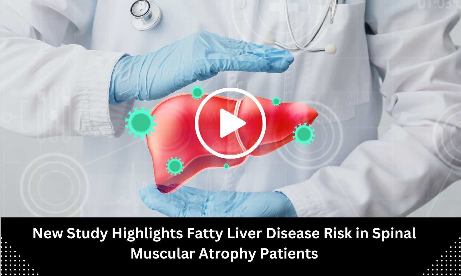 New Study Highlights Fatty Liver Disease Risk in Spinal Muscular ...