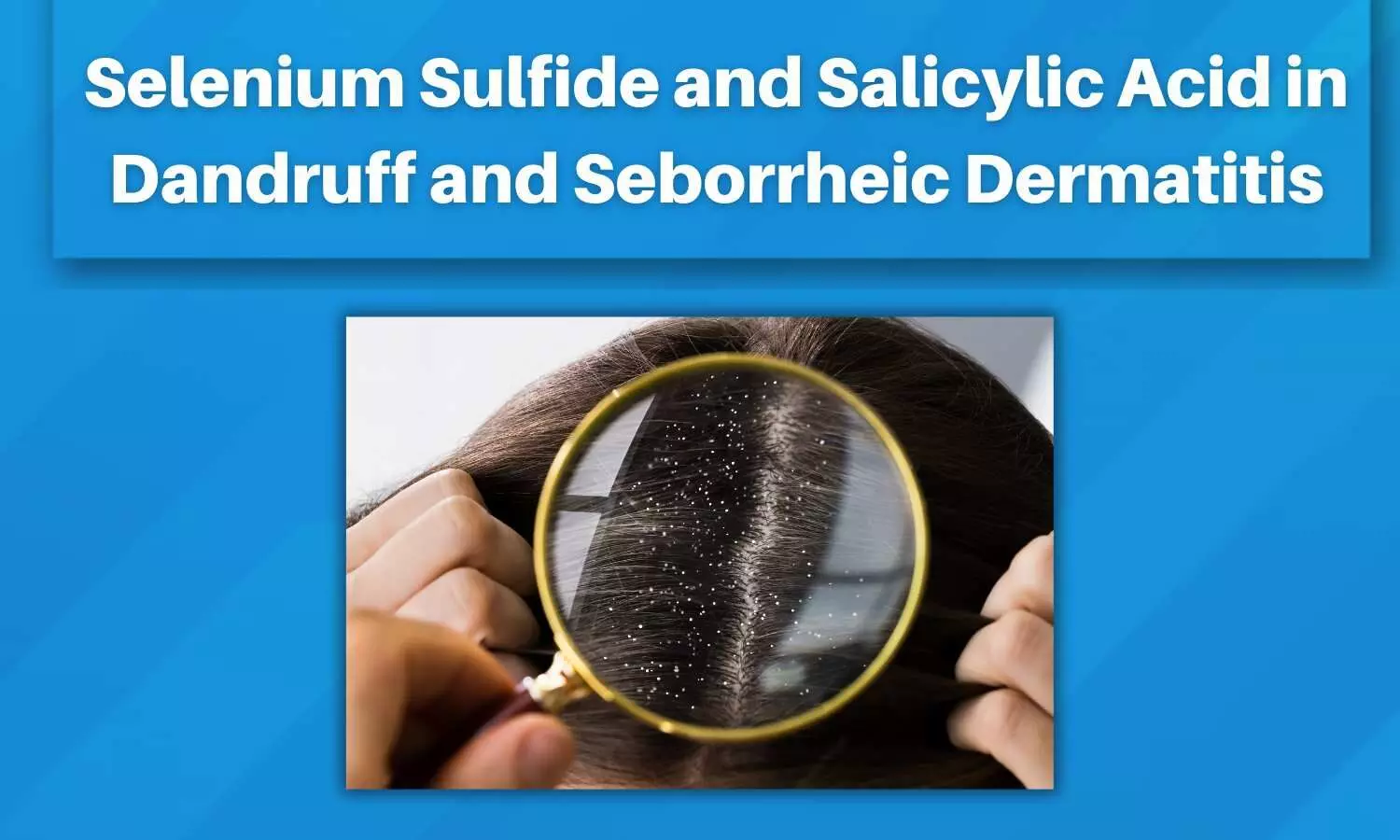 selenium sulfide description