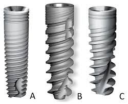 Tapered and cylindrical implants offer comparable clinical performance ...
