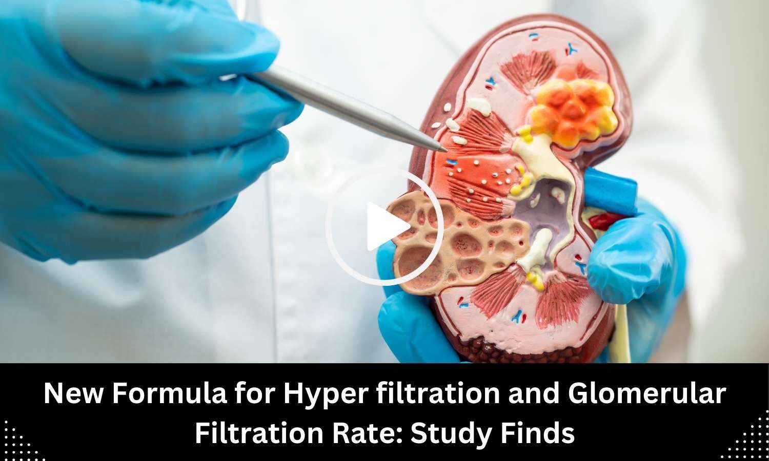 Study Uncovers New Formula for Hyper filtration and Glomerular ...