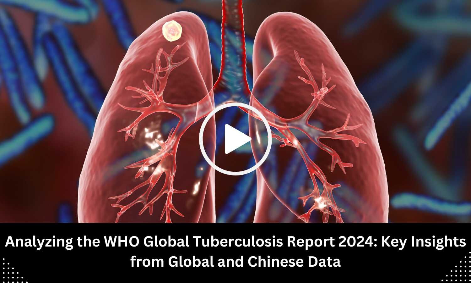 Analyzing the WHO Global Tuberculosis Report 2024: Key Insights from ...