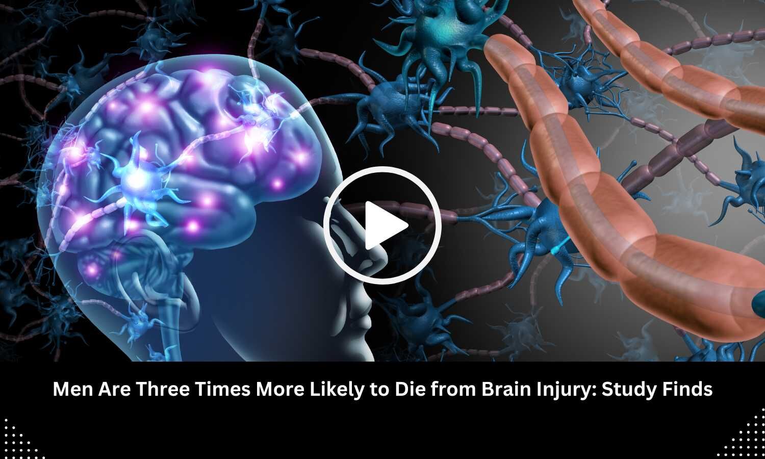 Men Are Three Times More Likely to Die from Brain Injury: Study Finds