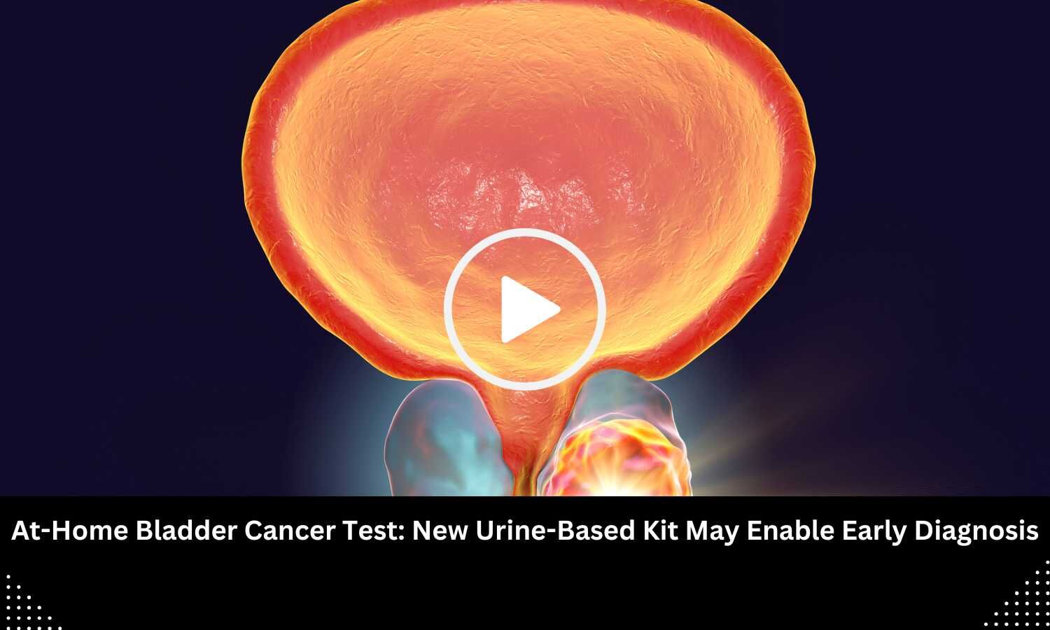 At-Home Bladder Cancer Test: New Urine-Based Kit May Enable Early ...