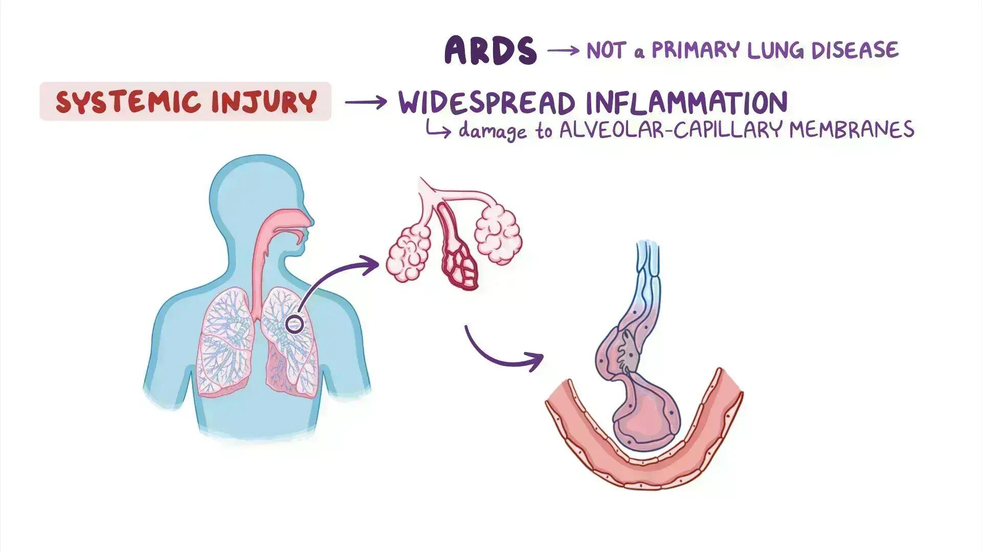 Intravenous Propofol bests Inhaled Sevoflurane for improving ...