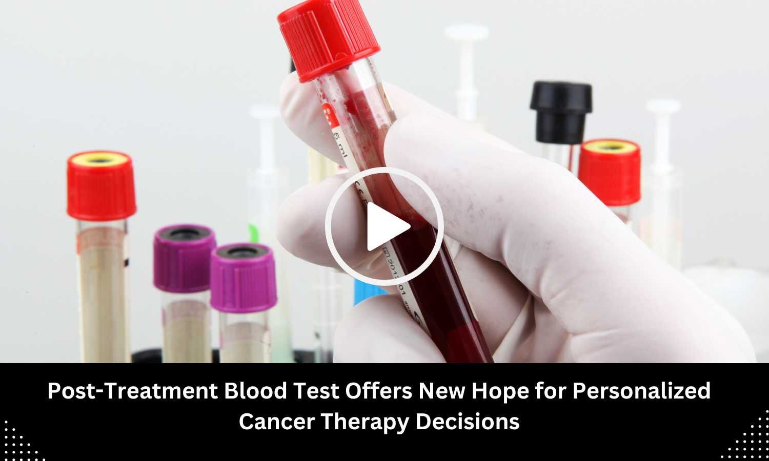 Post-Treatment Blood Test Offers New Hope for Personalized Cancer ...