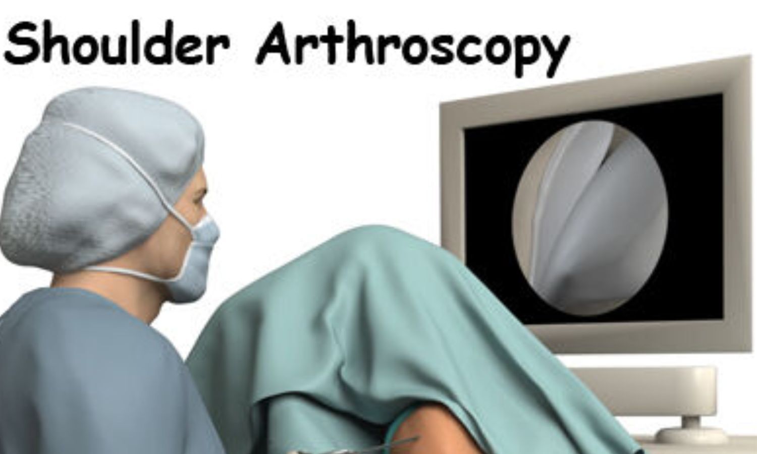 Arthroscopic adhesiolysis exerts beneficial outcomes for elderly ...