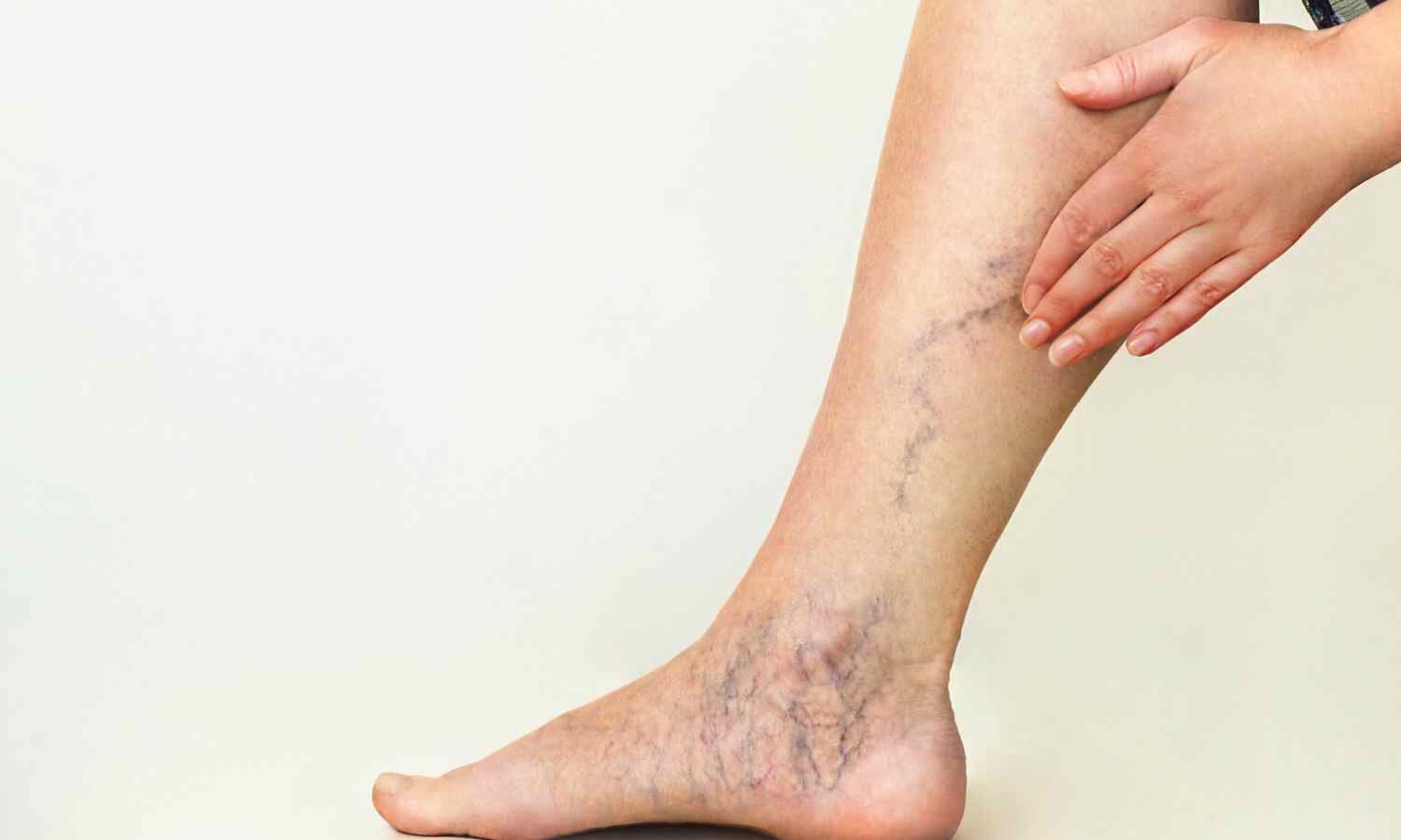 Symptoms of Ice cold feet plus heaviness in legs strongly linked to ...