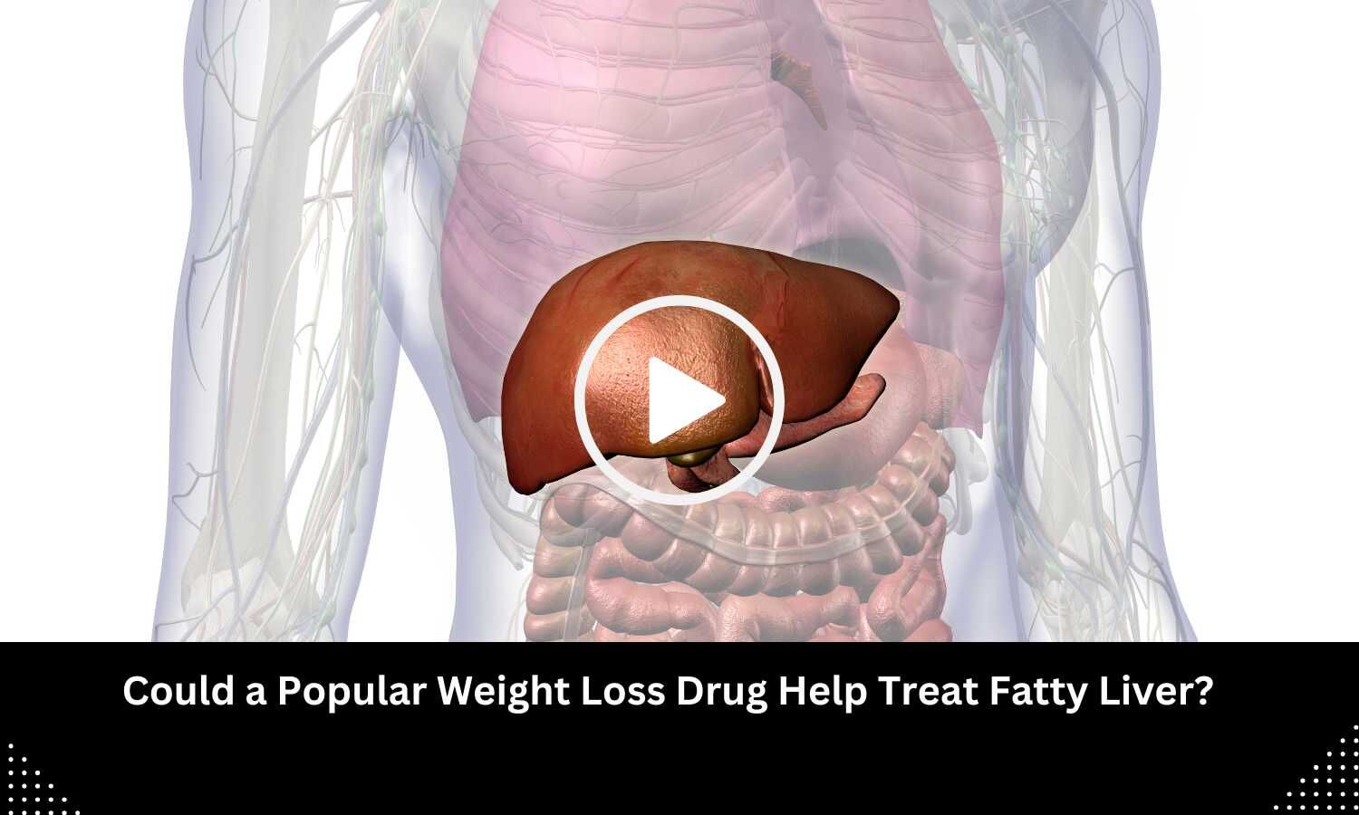 Could a Popular Weight Loss Drug Help Treat Fatty Liver? Study Sheds Light