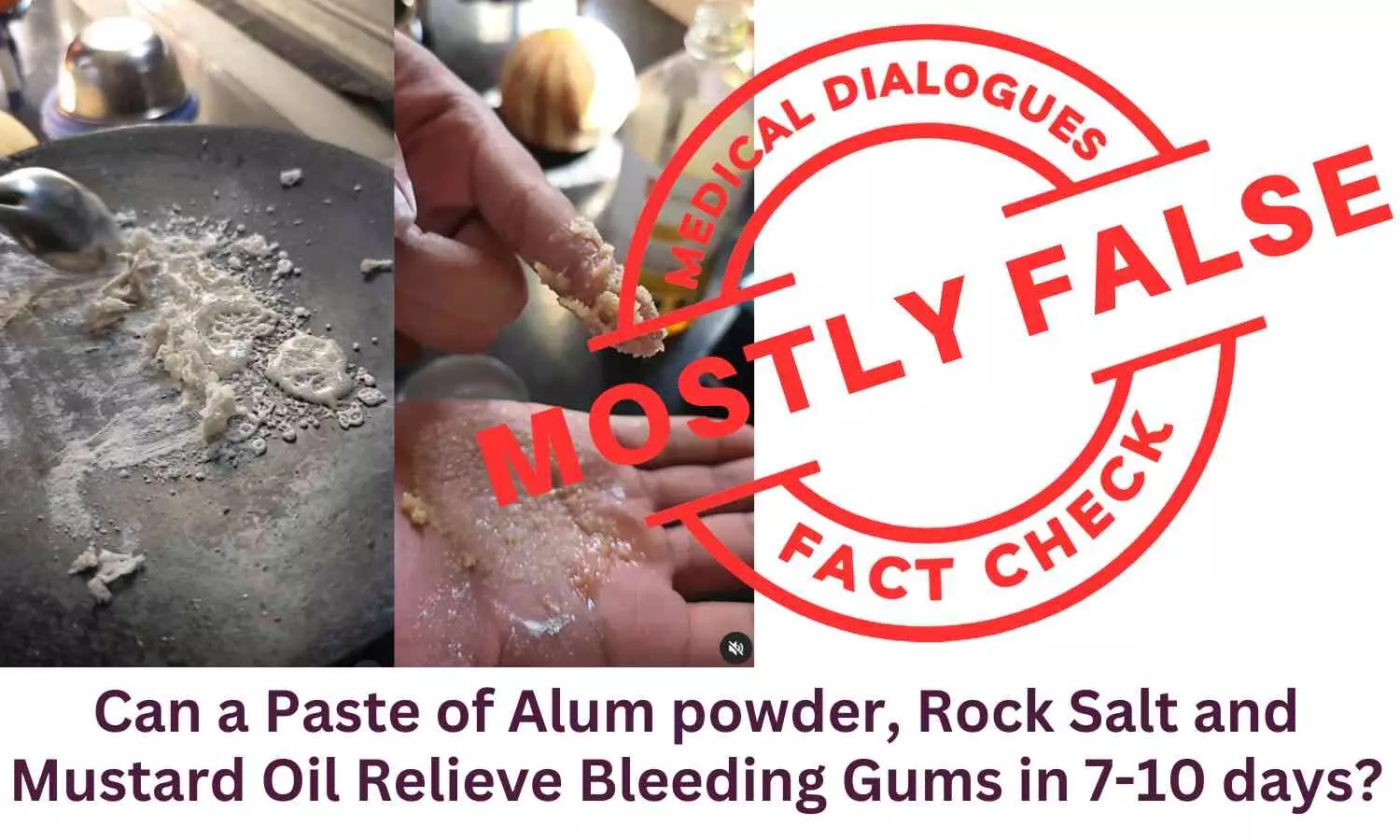 Fact Check: Can a Paste of Alum powder, Rock Salt and Mustard Oil Relieve Bleeding Gums in 7-10 ...